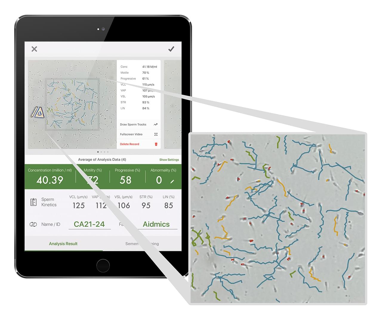 iSperm mCASA は精子の運動軌跡(トラッキング)をはっきり視覚化し、濃度、運動性、速度を分析することが可能です。